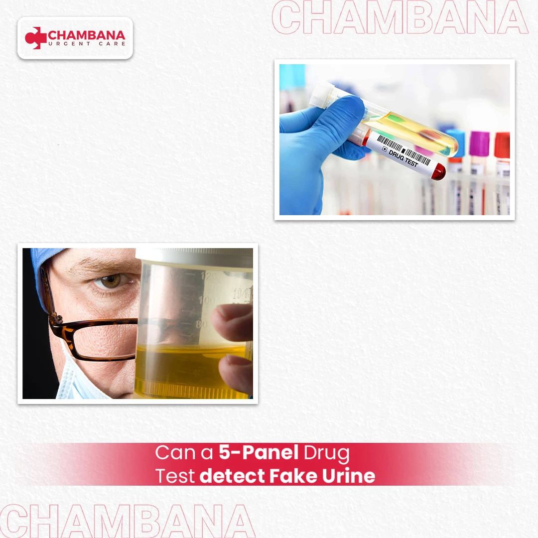Can A 5-Panel Drug Test Detect Fake Urine?